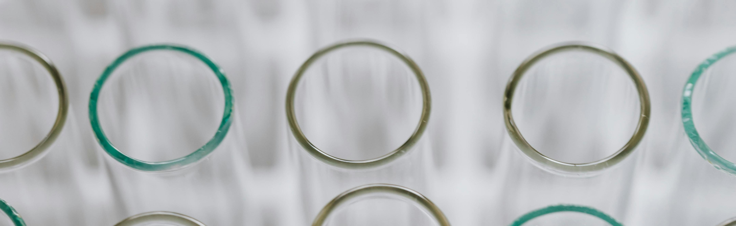 Test Management in SAP Cloud ALM - The World Management